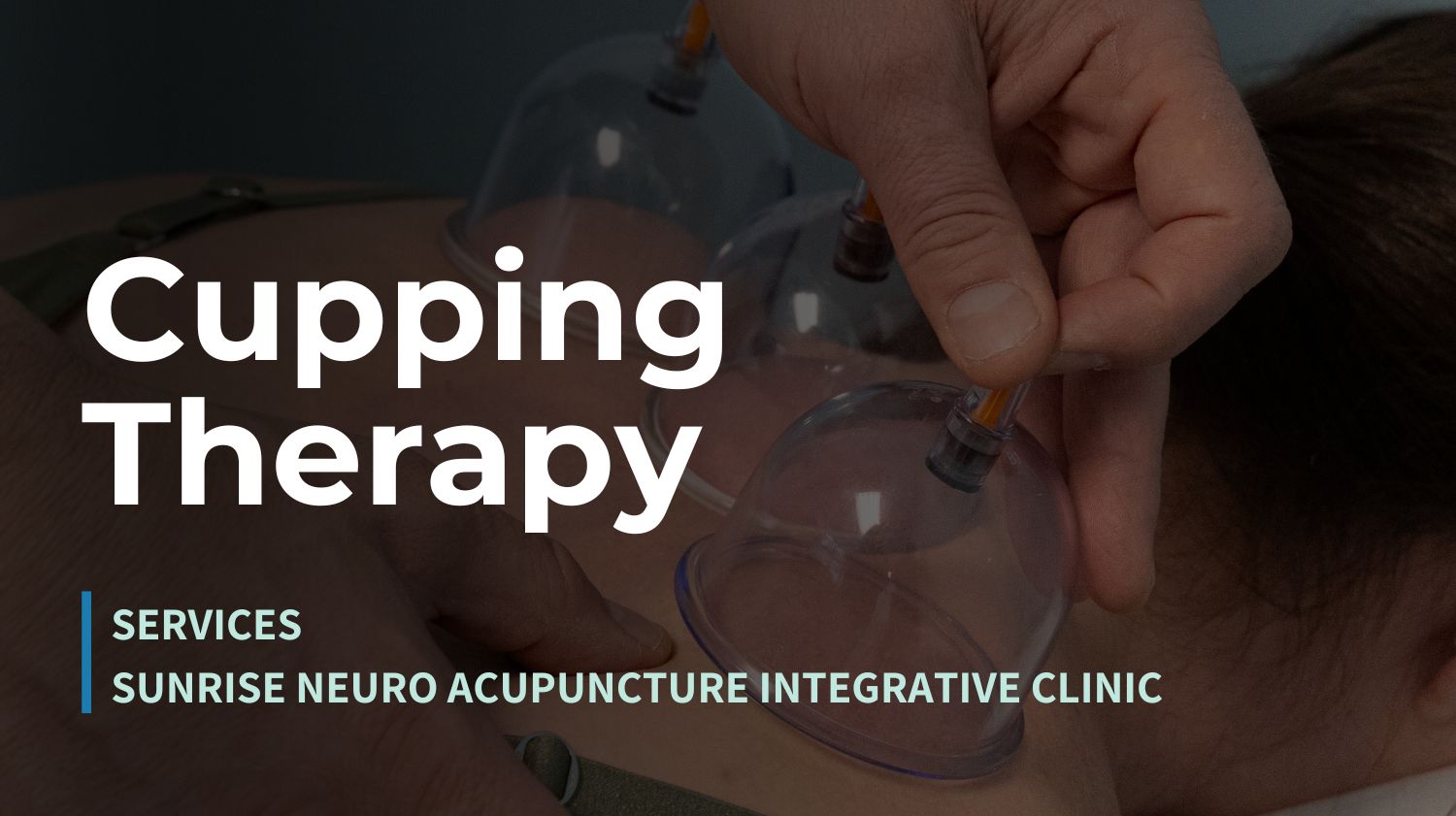 Cupping Therapy in Ottawa | TCM Neuro Acupuncture Clinic
